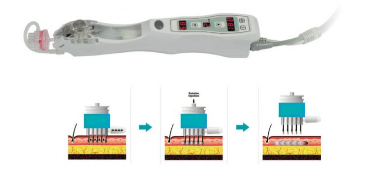 Ice Shot Mesotherapy Injector, a skin boosters injection device with ...