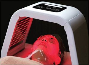 New concept PDT acne treatment, PDT Gel for PDT photodynamic therapy